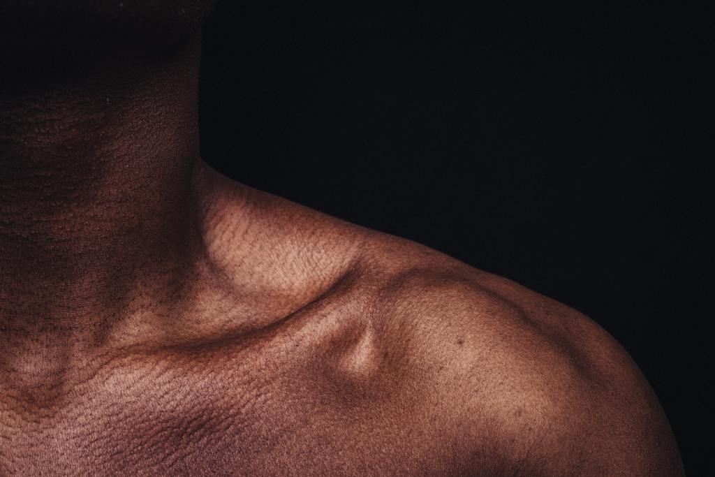 3 Ways to Relieve a Stiff Neck and Headache - Underwood Healthcare